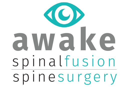 Awake Spinal Fusion - Located in Matawan, New Jersey