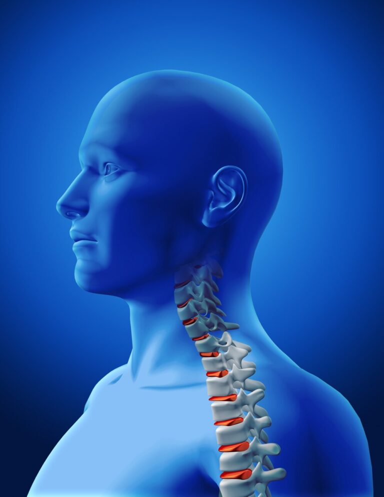 Adjusting to Life After ACDF Surgery - ACDF Surgery NJ